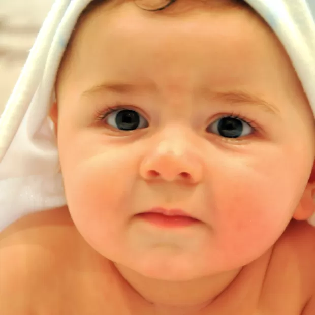 Todo sobre Symmed facial: opiniones y cuidados tras radiofrecuencia ...